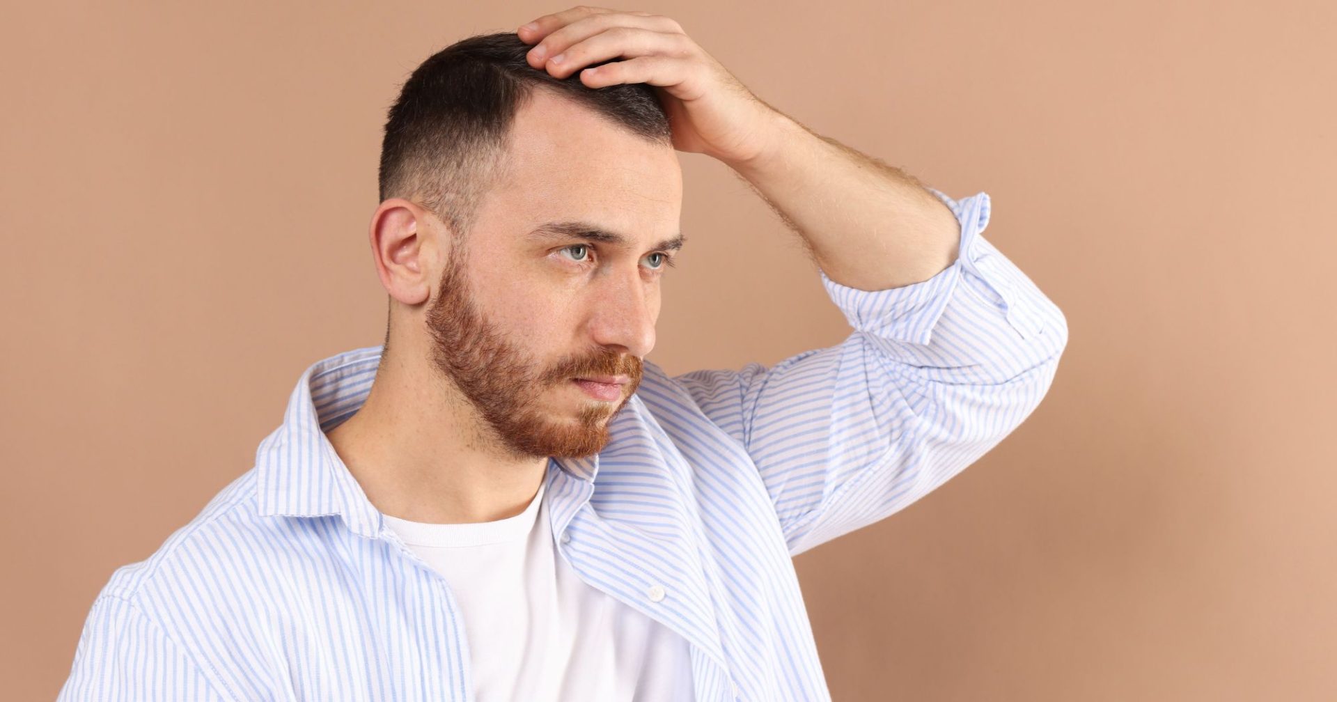 Can You Restore a Receding Hairline Without Surgery?