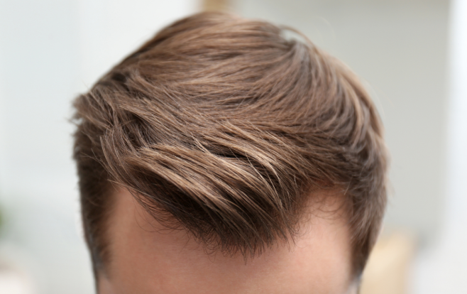 Why Thinning Edges Happen—and How to Restore Them